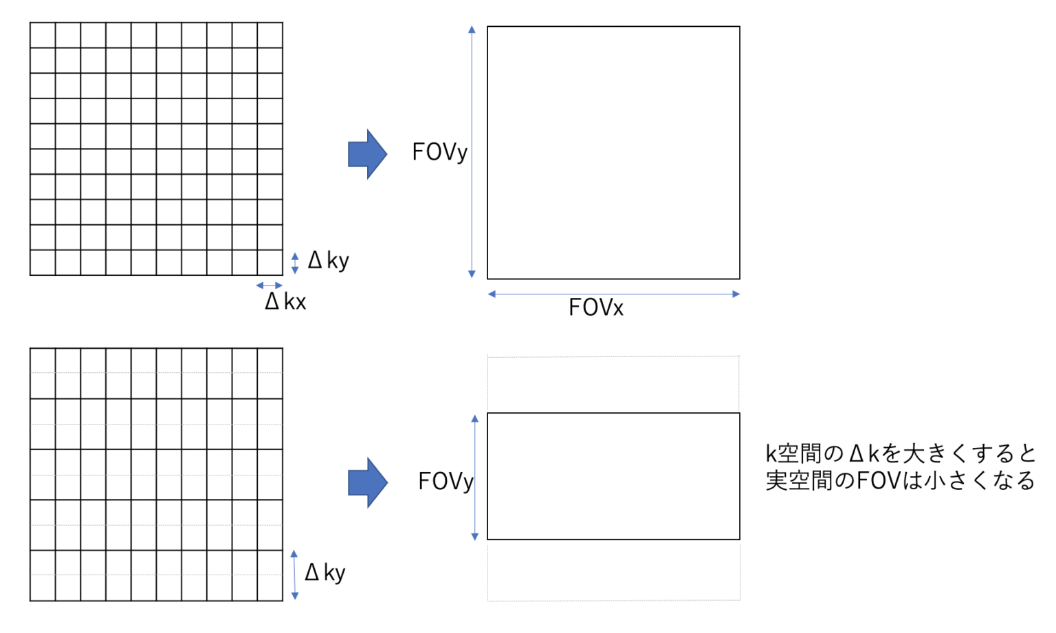 MRI認定試験過去問解説 第5回-20【パラレルイメージング】 | ラドライフ