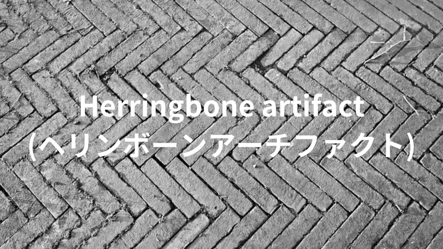 Herringbone artifact(ヘリンボーンアーチファクト) | ラドライフ