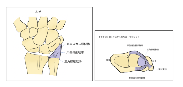 三角線維軟骨複合体(TFCC)損傷 | ラドライフ