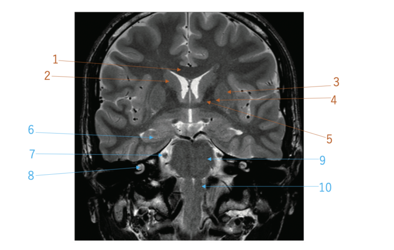 MRI認定の画像問題まとめ(解剖) | ラドライフ