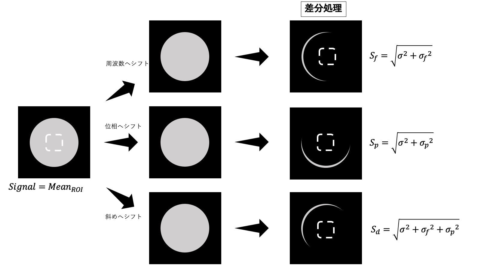【MRI認定 12】SNR測定について | ラドライフ